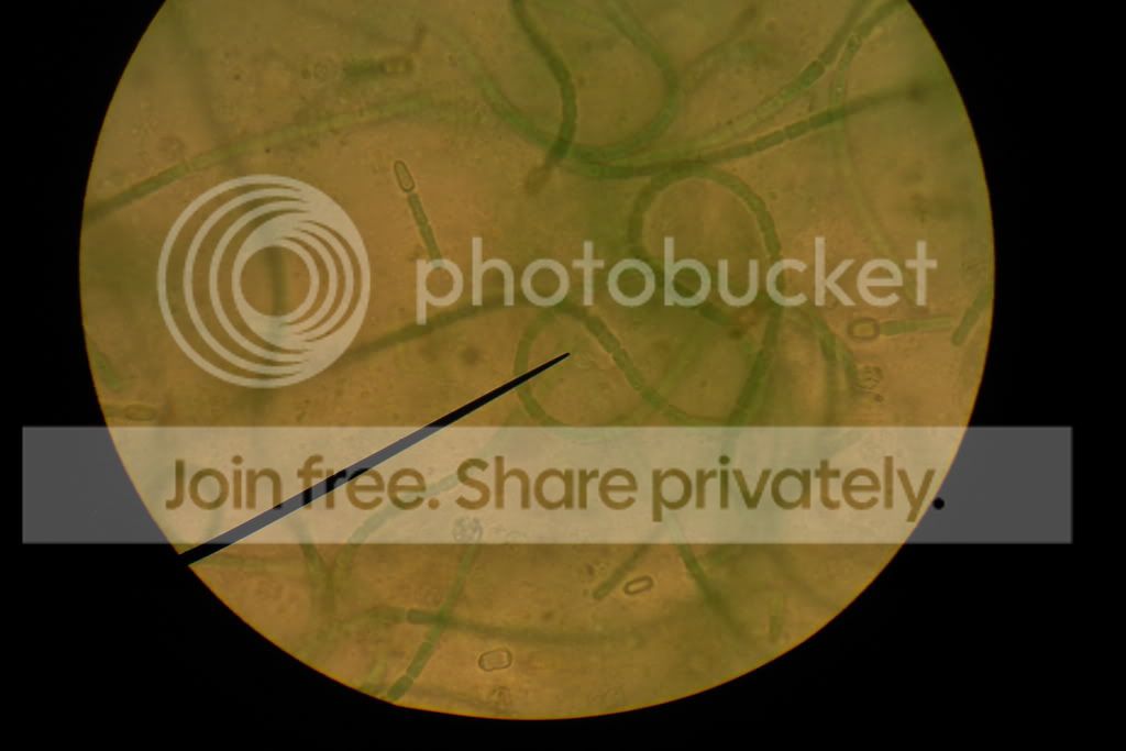 Anabaena 40x